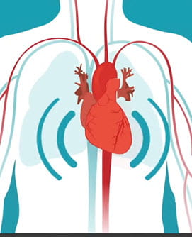 Heart Failure | American Heart Association Recipes