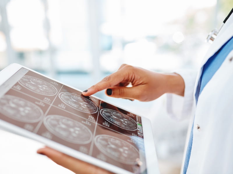 Deadly type of stroke increasing among younger and middle-aged adults ...